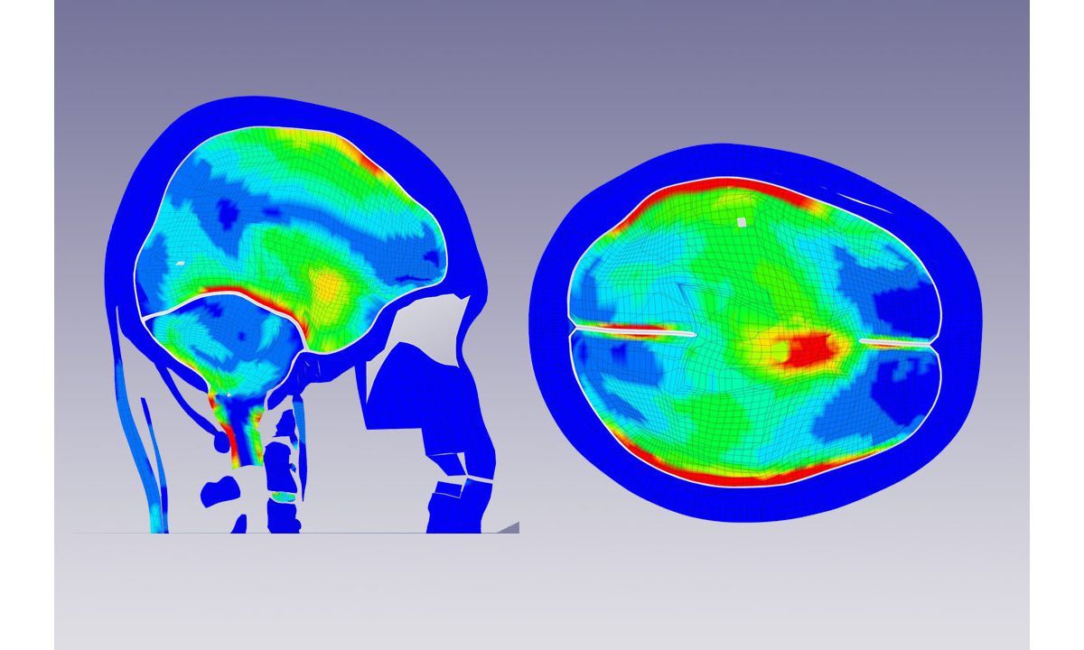 Healthcare Industry Webcast Series | Ansys