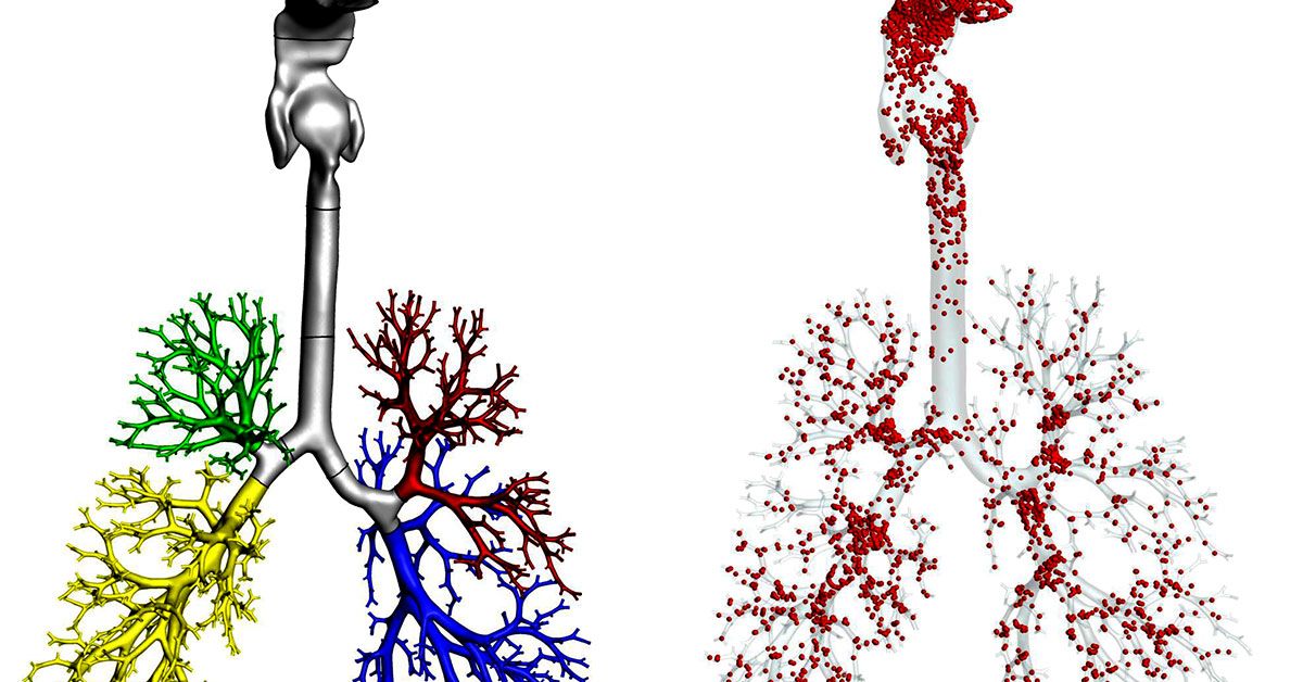 Digital Twin of the Respiratory System Tracks Toxic Particles