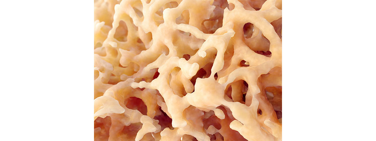 Are Bones Stronger than Steel?