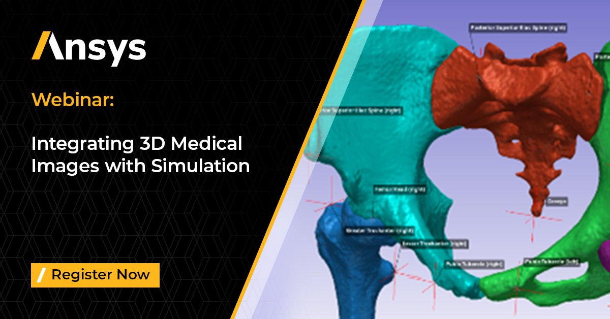 Integrating 3D Medical Images with Simulation | Ansys